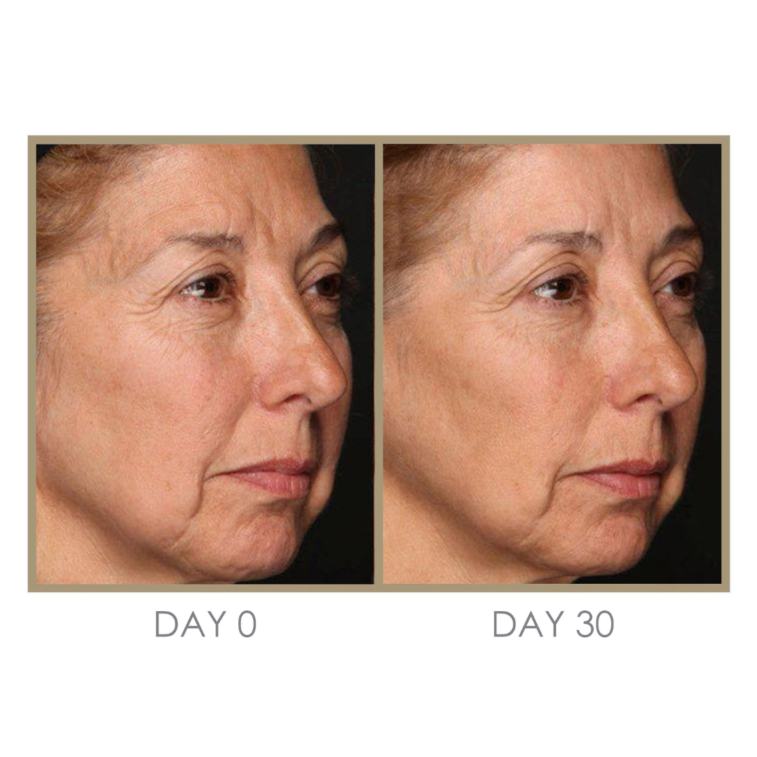 Dream Cream Moisturizing Treatment – Genie Beauty Products